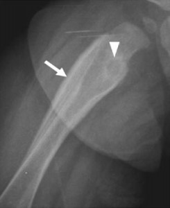 Periosteum Definition, Location, Anatomy, Histology and Function ...